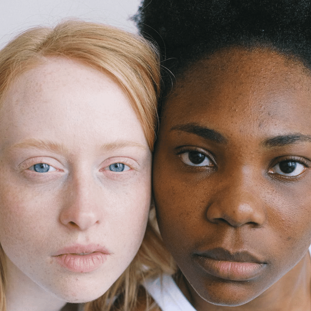 Dull, Dry Skin - VIVA Skin Clinics