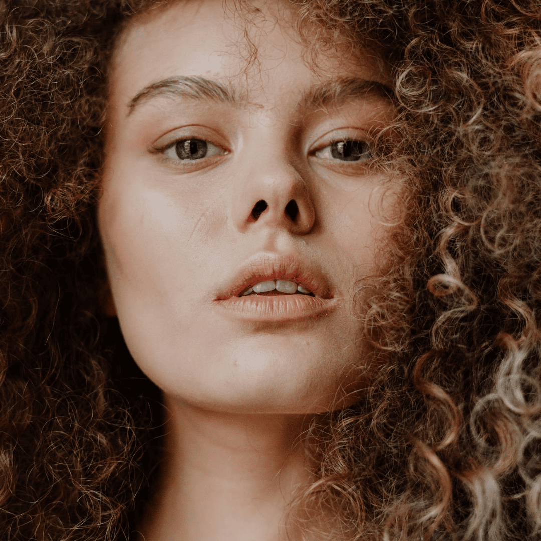 Nasolabial Folds - VIVA Skin Clinics