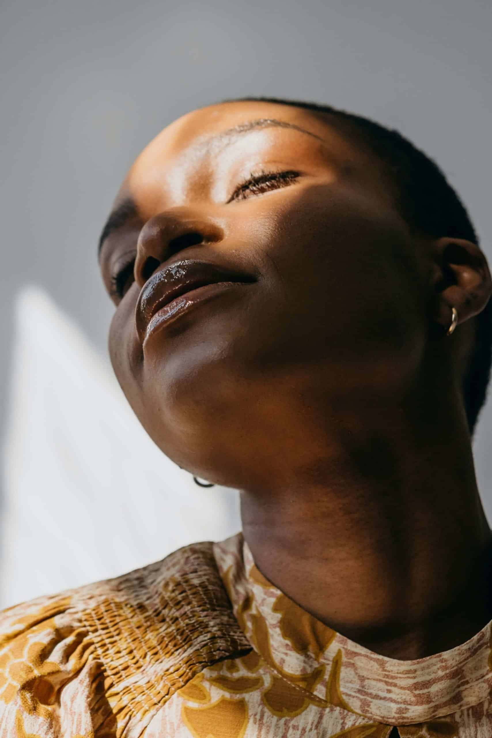 Side-Effects of Dermal Filler: What Is Normal? - VIVA Skin Clinics